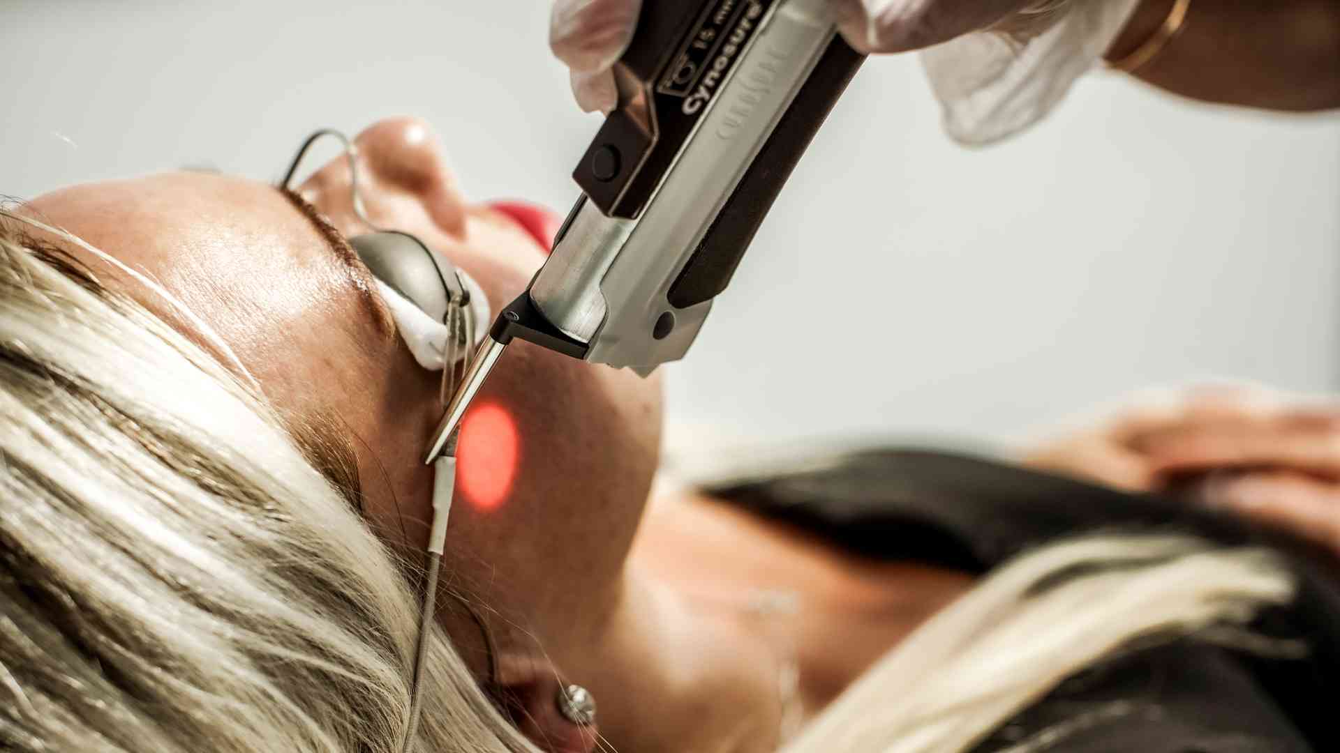 Laser Skin Rejuvenation - Real Body Clinic